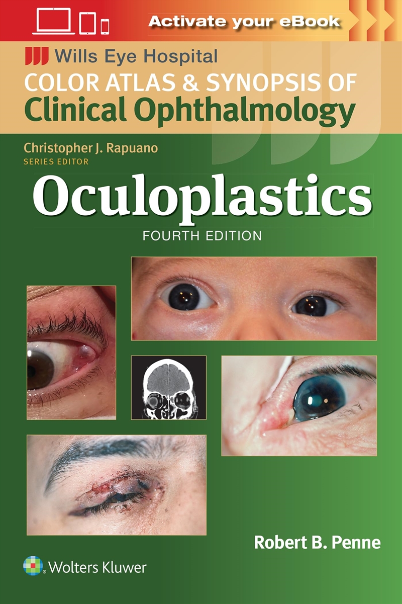 Buy Oculoplastics (Wills Eye Institute Atlas Series) Online | Sanity
