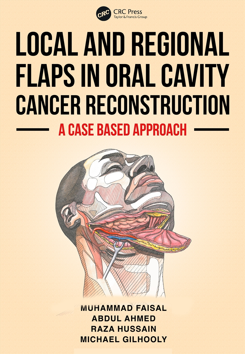 Muhammad Faisal - Local And Regional Flaps In Oral Cavity Cancer ...