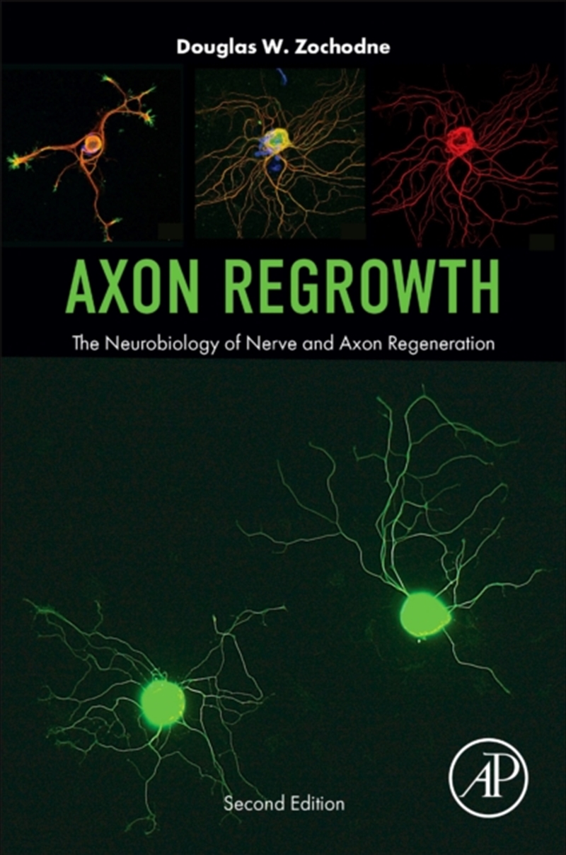 Buy Axon Regrowth : The Neurobiology of Nerve and Axon Regeneration ...