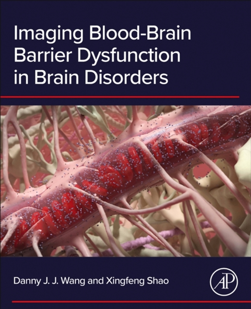 Buy Imaging Blood-Brain Barrier Dysfunction in Brain Disorders Online ...
