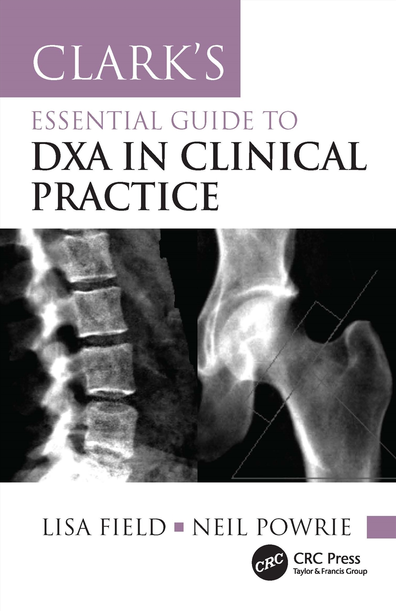Lisa Field - Clark's Essential Guide to DXA in Clinical Practice ...
