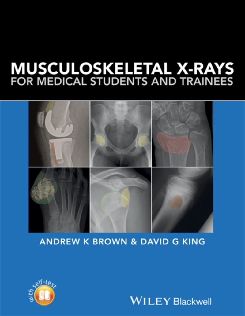 Buy Musculoskeletal X-Rays For Medical Students And Trainees Online ...